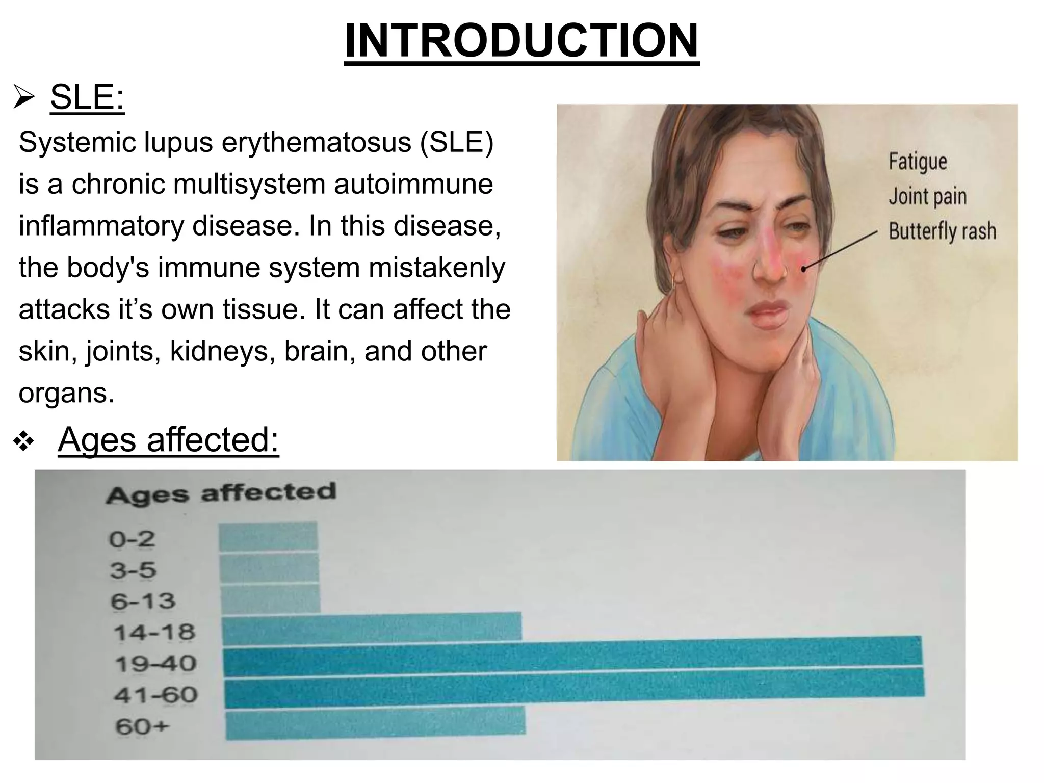 SYSTEMIC LUPUS ERYTHEMATOSUS (SLE) | PPTX