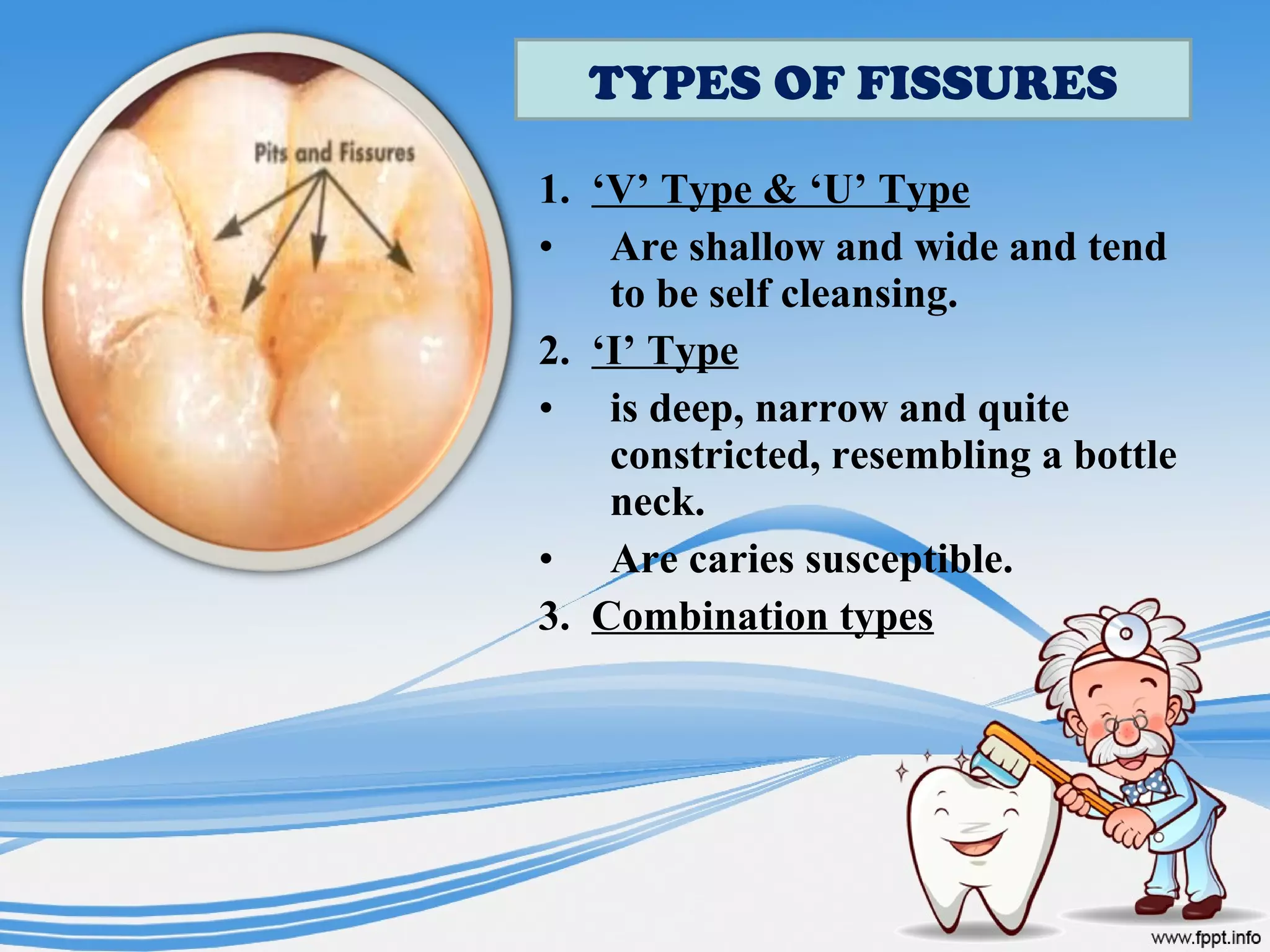 PIT AND FISSURE SEALANTS- PUBLIC HEALTH DENTISTRY | PPT