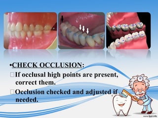 PIT AND FISSURE SEALANTS- PUBLIC HEALTH DENTISTRY | PPT