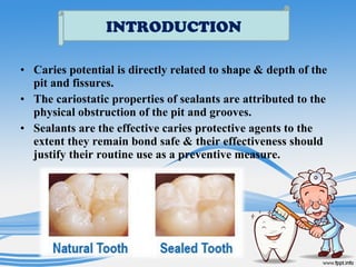 PIT AND FISSURE SEALANTS- PUBLIC HEALTH DENTISTRY | PPT