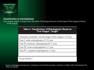 Ankyloglossia (Tongue-tie) | PPT
