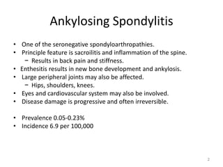 Ankylosing spondylitis | PPT