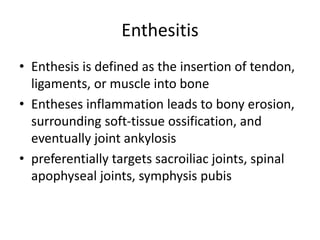 Ankylosing spondilitis | PPTX