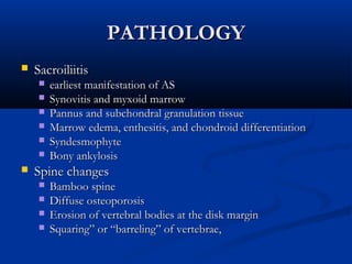 Ankylosing spondilitis | PPT