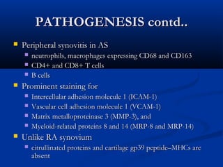 Ankylosing spondilitis | PPT