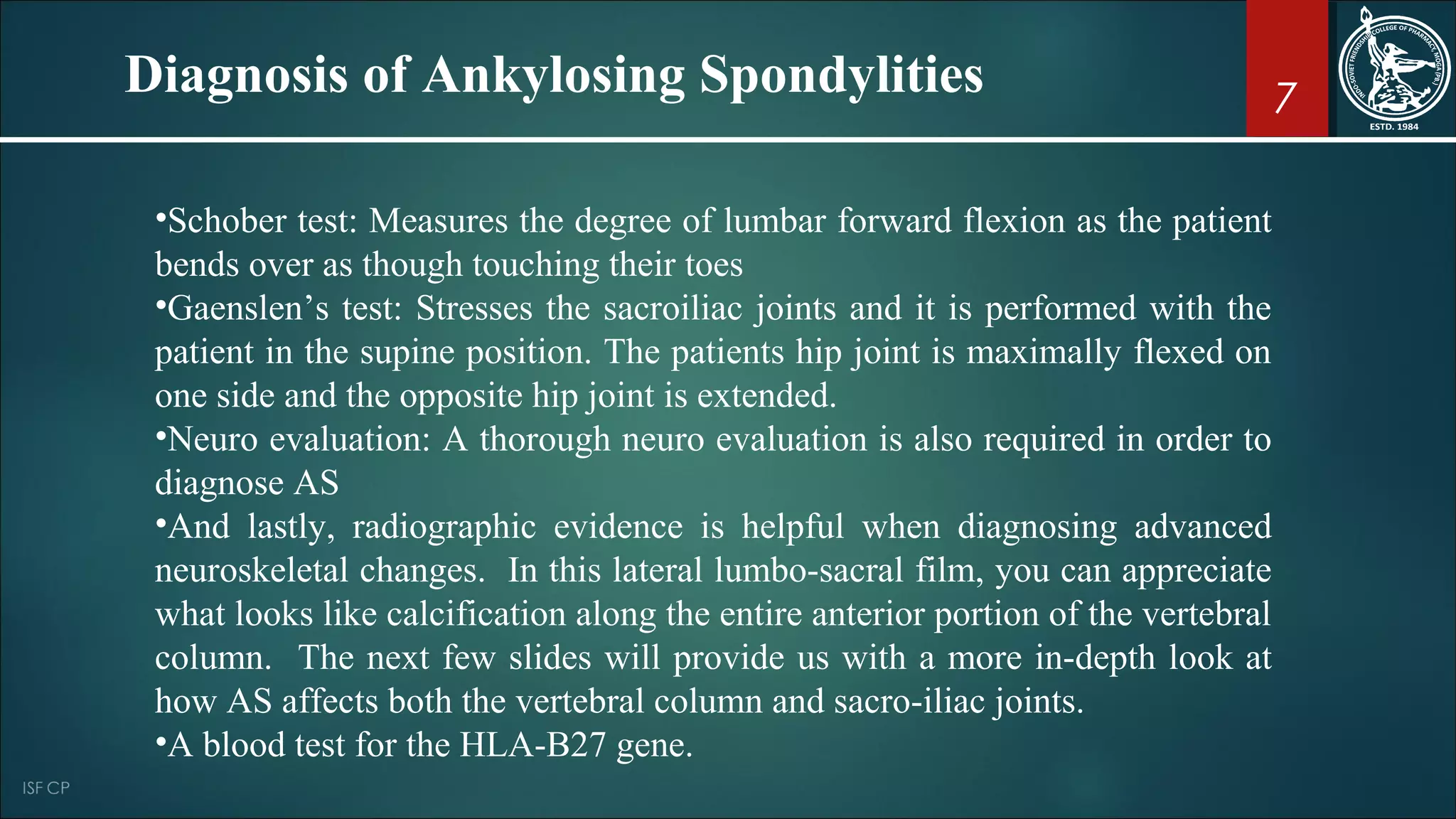 Ankylosing spondylities | PPT