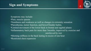 Ankylosing spondylities | PPT