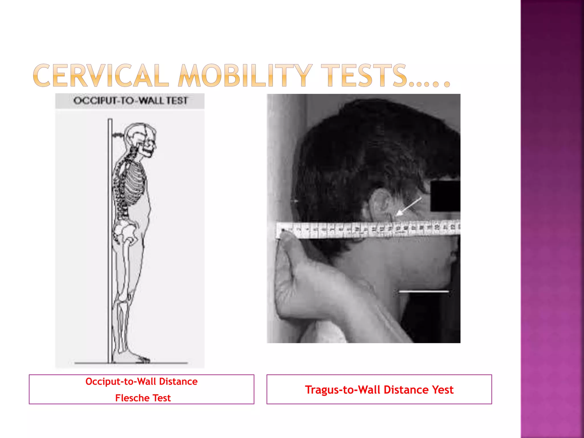 ANKYLOSING SPONDYLITIS-1.pptx