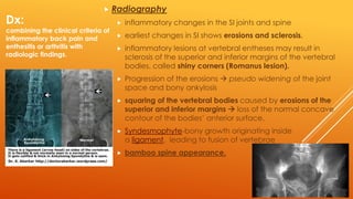 Ankylosing spondylitis | PPTX