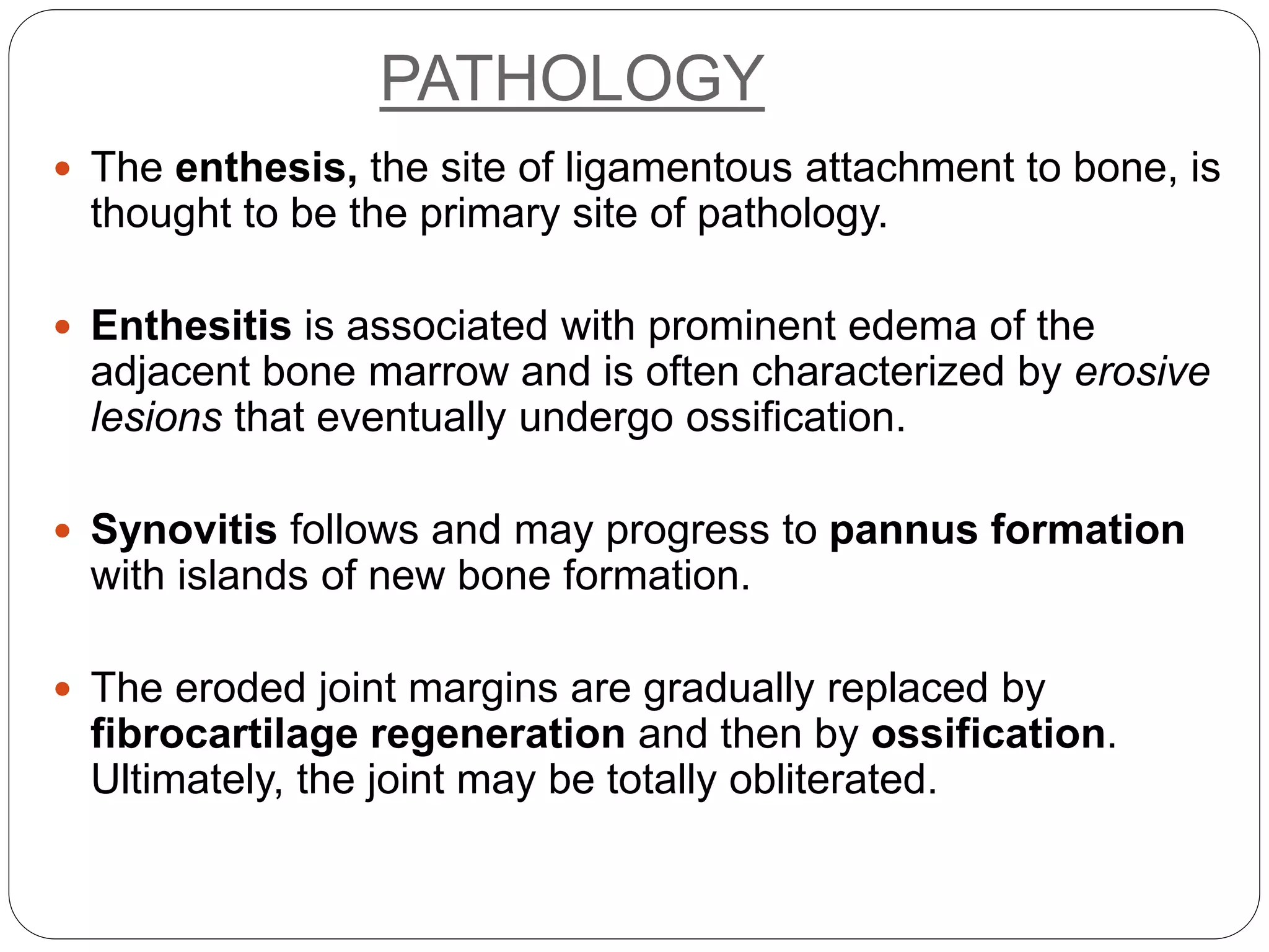 Ankylosing spondylitis. (ben) | PPTX