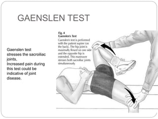 Ankylosing spondylitis. (ben) | PPTX | Bone and Joint Conditions ...