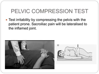 Ankylosing spondylitis. (ben) | PPTX | Bone and Joint Conditions ...