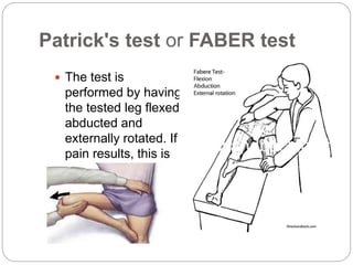 Ankylosing spondylitis. (ben) | PPTX | Bone and Joint Conditions ...
