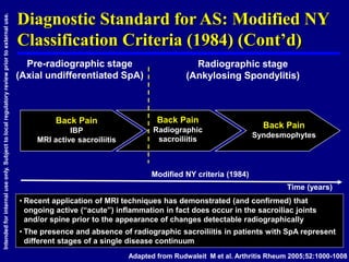 Ankylosing spondylitis | PPTX