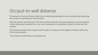 Ankylosing spondylitis | PPTX