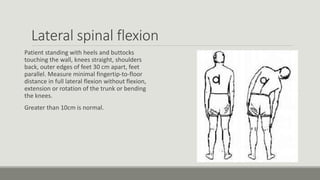 Ankylosing spondylitis | PPTX