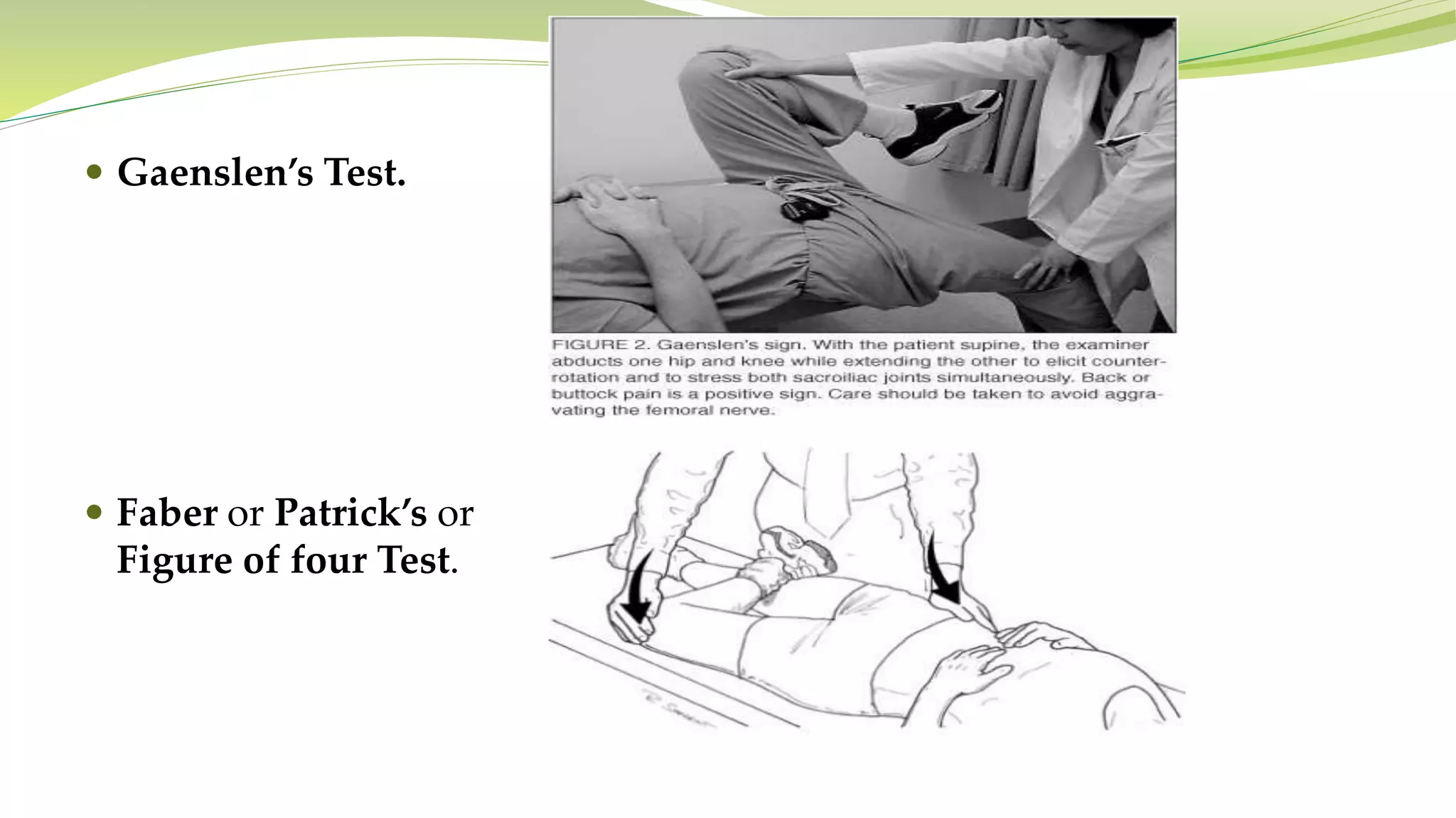 Ankylosing spondylitis | PPTX