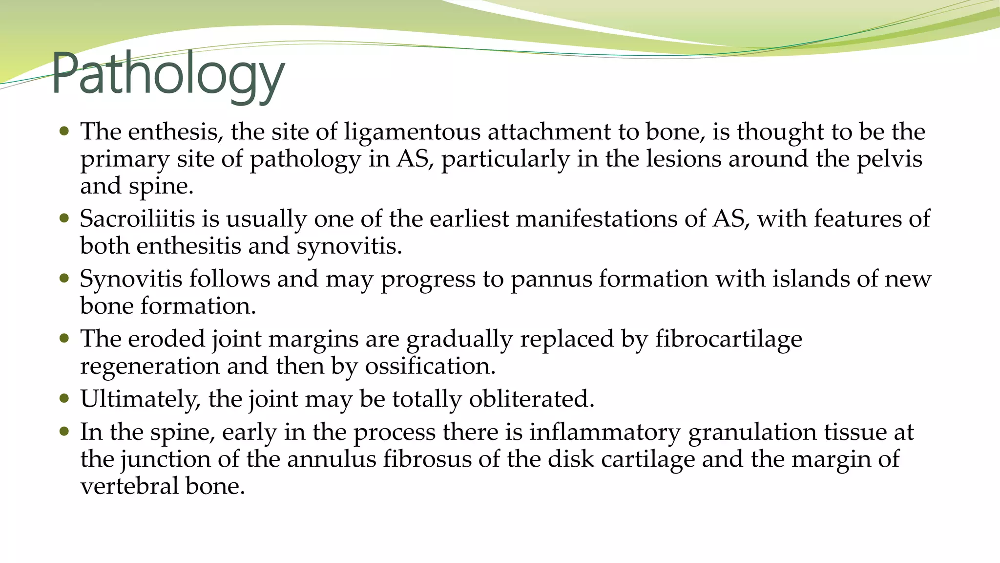 Ankylosing spondylitis | PPTX