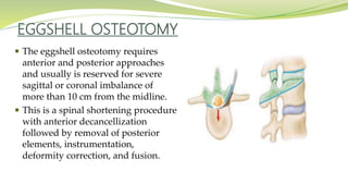 Ankylosing spondylitis | PPTX