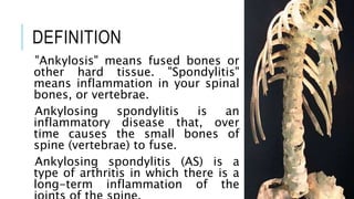 Ankylosing spondylitis | PPT