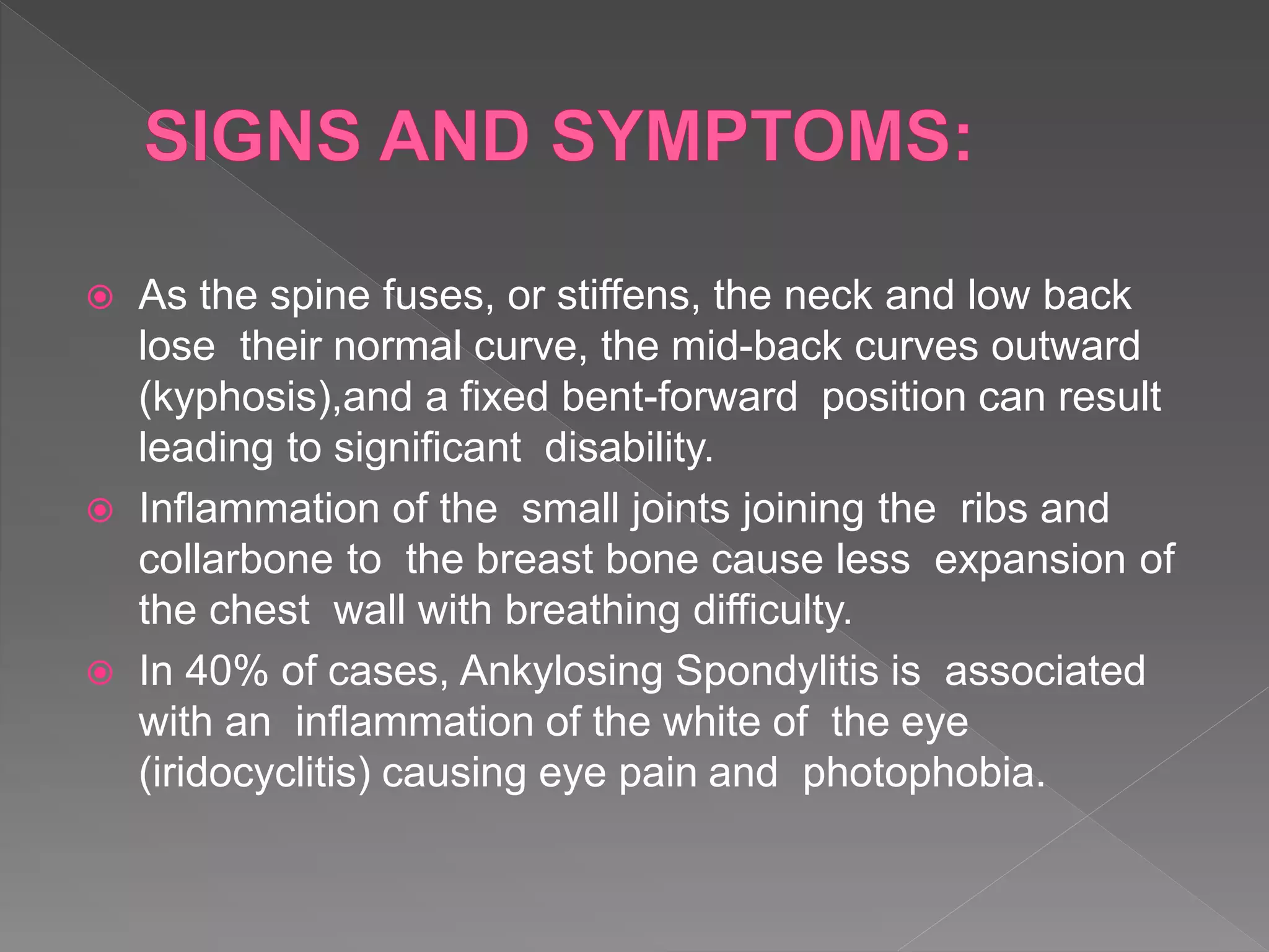 Ankylosing spondylitis | PPTX