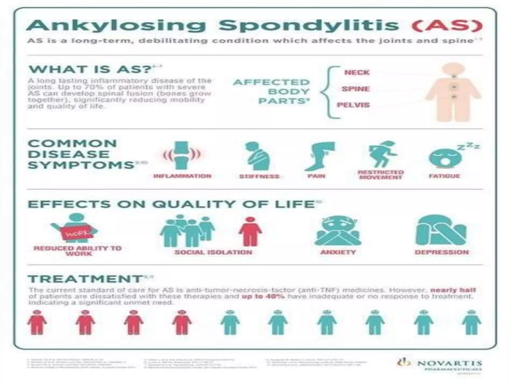 Ankylosing spondylitis | PPT