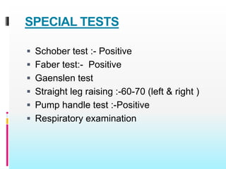 Ankylosing spondylitis | PPT
