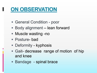 Ankylosing spondylitis | PPTX