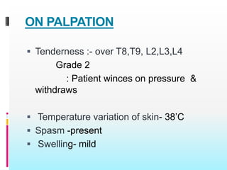 Ankylosing spondylitis | PPT