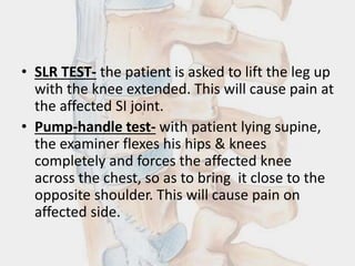 Ankylosing spondylitis | PPTX