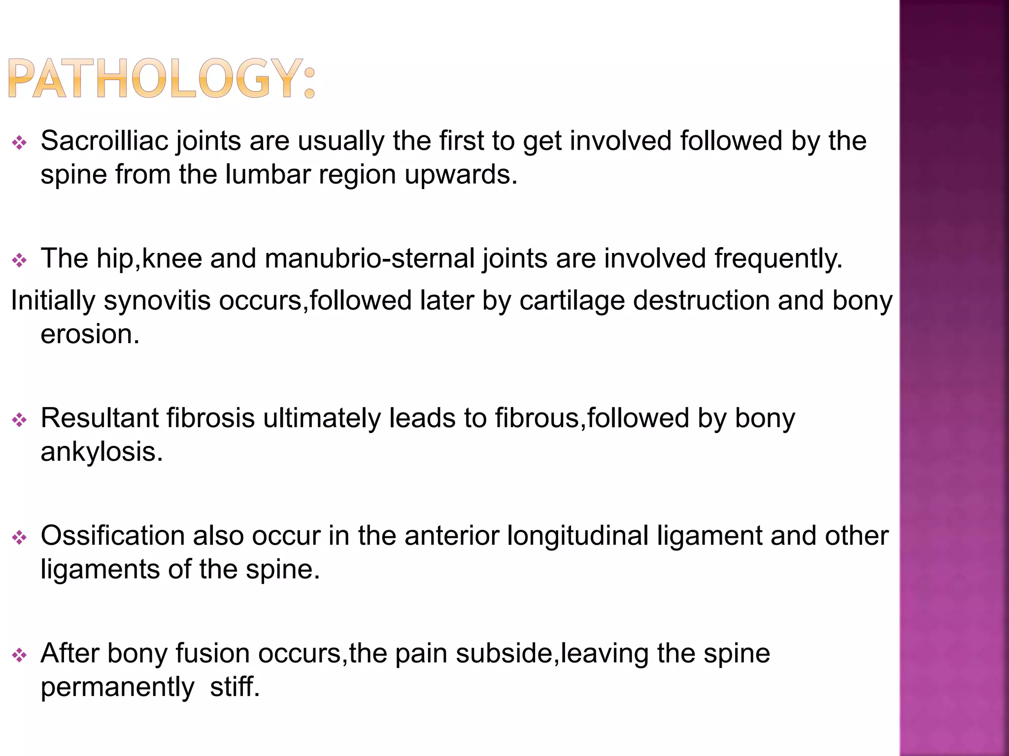 ankylosing spondylitis.pptx