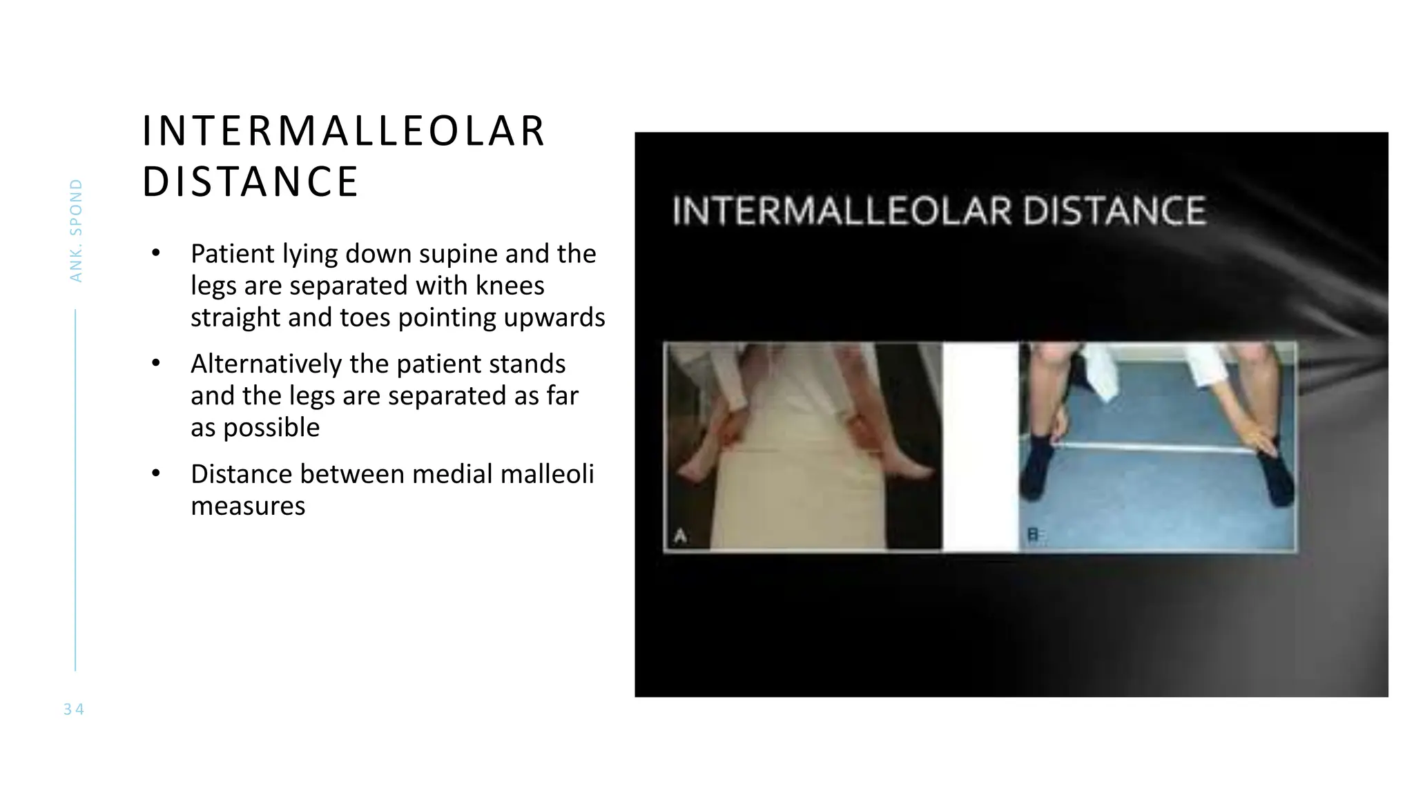 Ankylosing spondylitis.pptx