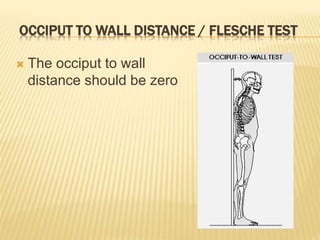 Ankylosing Spondylitis .pptx