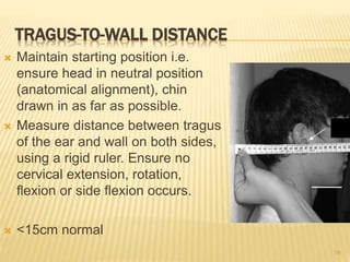 Ankylosing Spondylitis .pptx