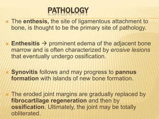 Ankylosing Spondylitis .pptx