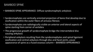 ANKYLOSING SPONDYLITIS RADIOLOGIC MANIFESTATIONS.pptx