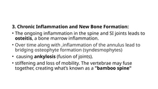 approach to diagnose ankylosing spondylitis.pptx