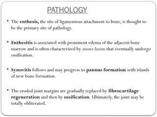 ankylosing spondylitis ankylosis sp.pptx