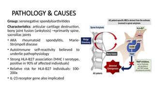 Ankylosing Spondylitis (Assessment and Physiotherapy Management) | PPTX