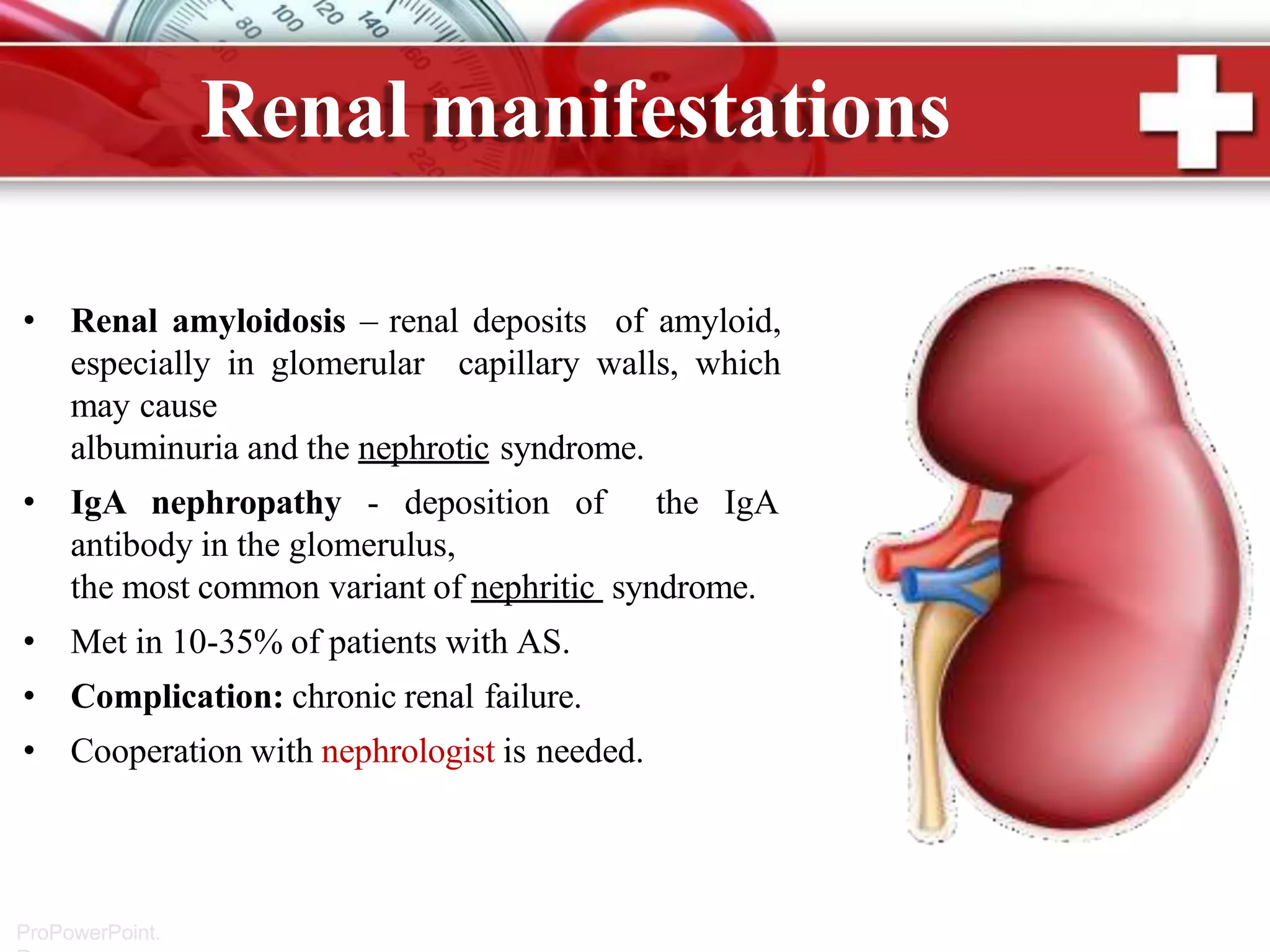 Ankylosing spondylitis by dr ashutosh | PPT
