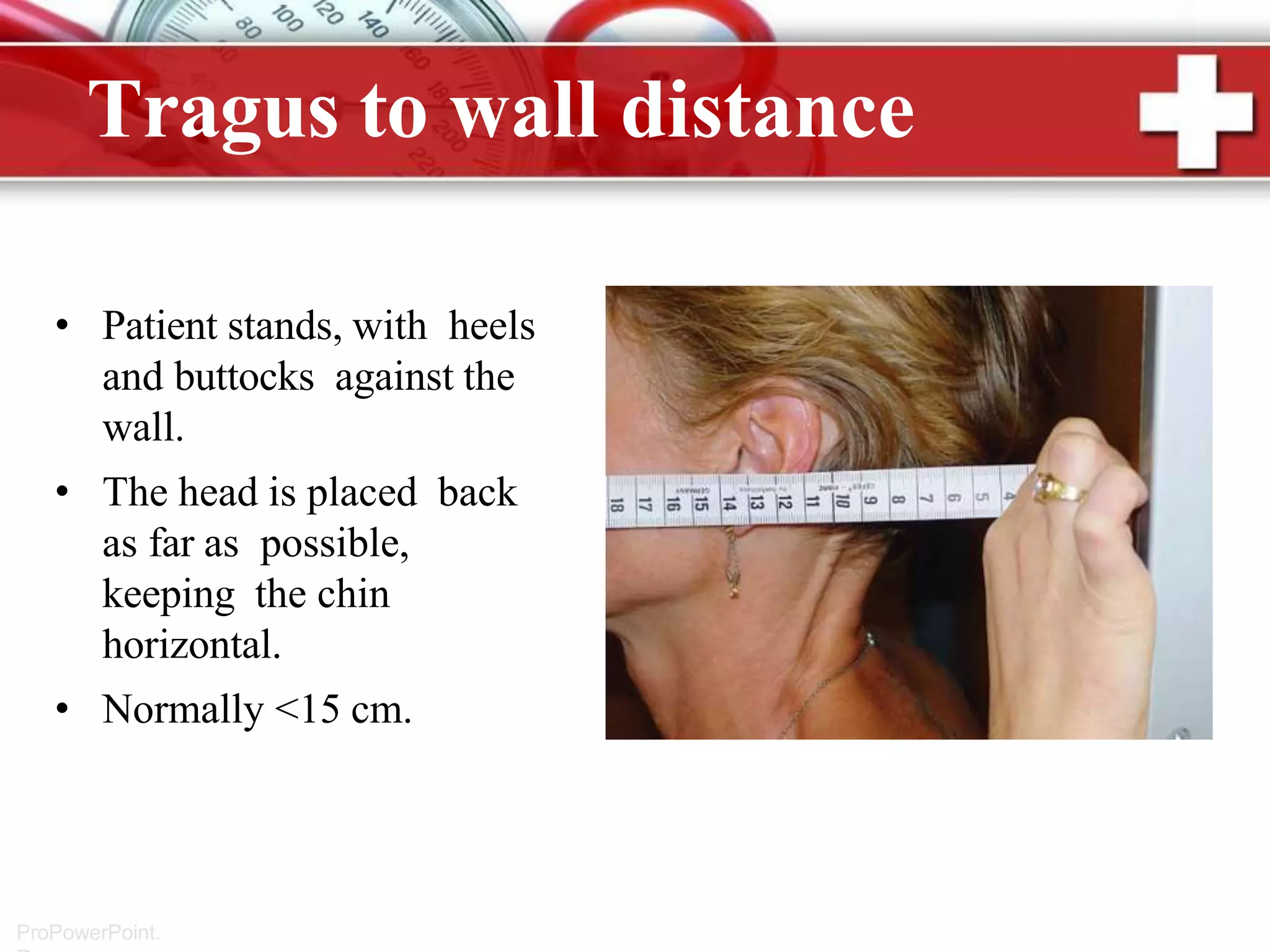 Ankylosing spondylitis by dr ashutosh | PPT