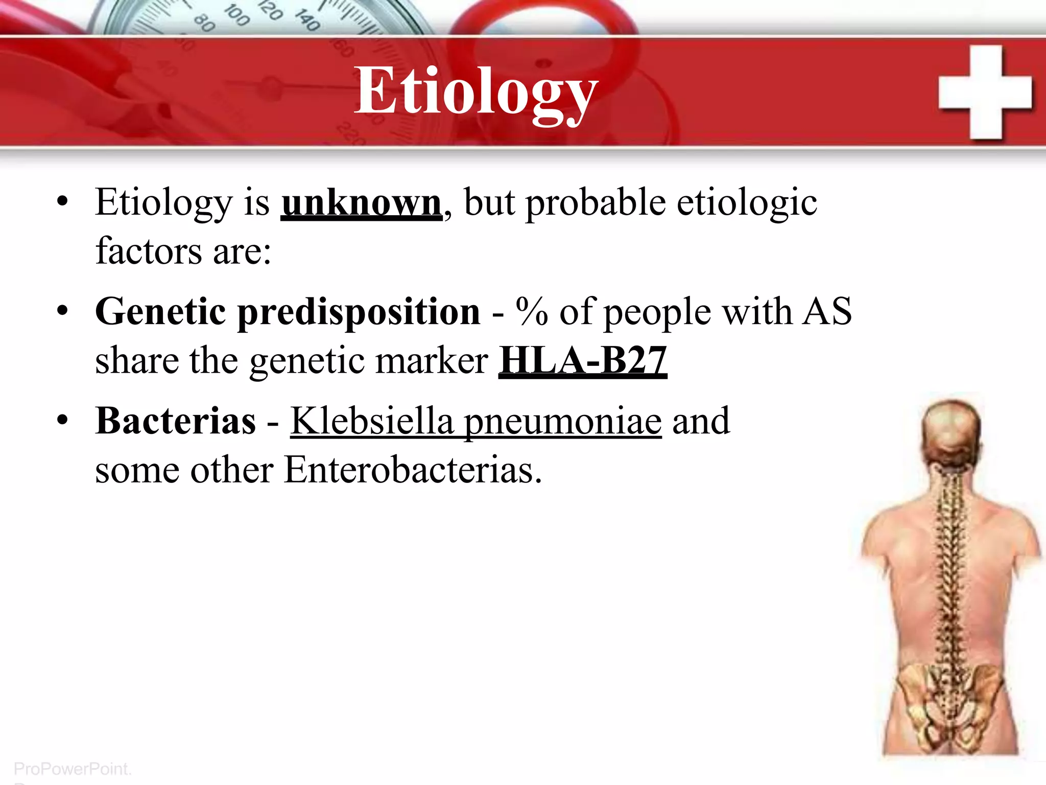 Ankylosing spondylitis by dr ashutosh | PPT