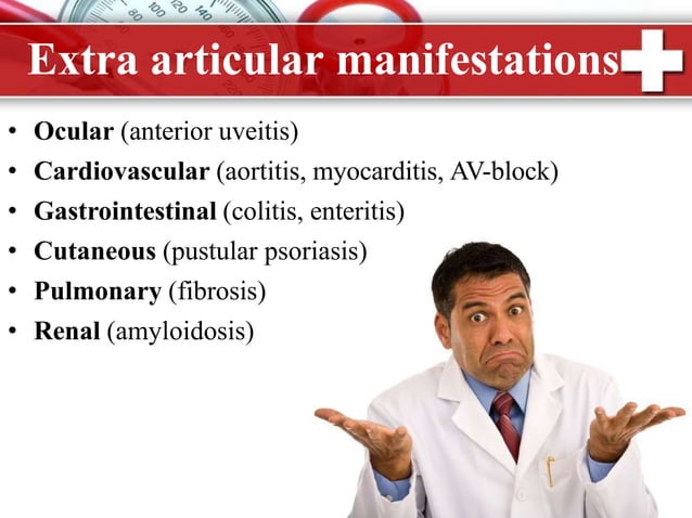 Ankylosing spondylitis by dr ashutosh | PPT