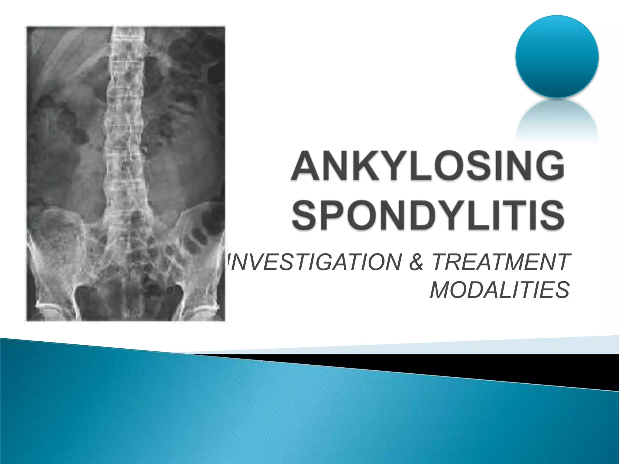 Ankylosing spondylitis management | PPTX