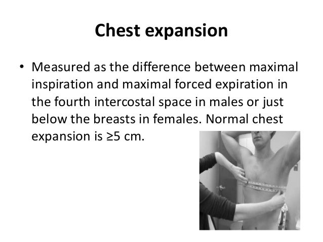 Ankylosing spondylitis UG lecture