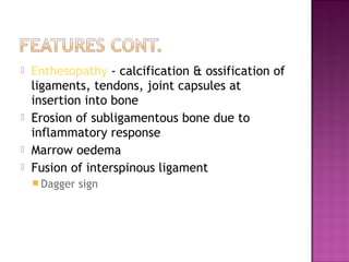 Ankylosing spondylitis pathogenesis | PPT