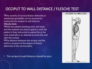 ankylosingspondylitis pk.pptx.............. | PPTX