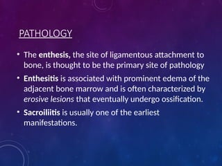 ankylosingspondylitis pk.pptx.............. | PPTX