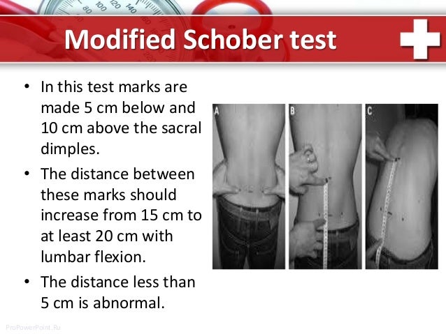 Ankylosing spondylitis. Self study materials for medical students.