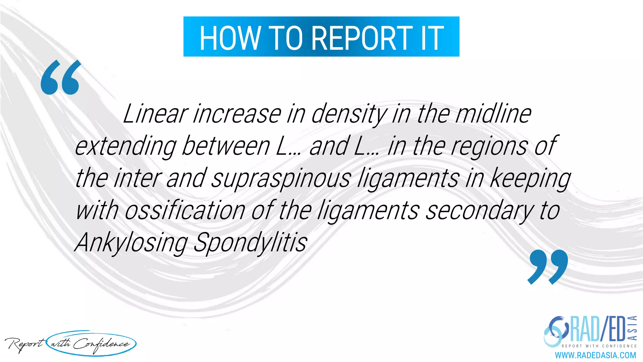 ANKYLOSING SPONDYLITIS SPINE IMAGING DAGGER SIGN RADEDASIA | PPT